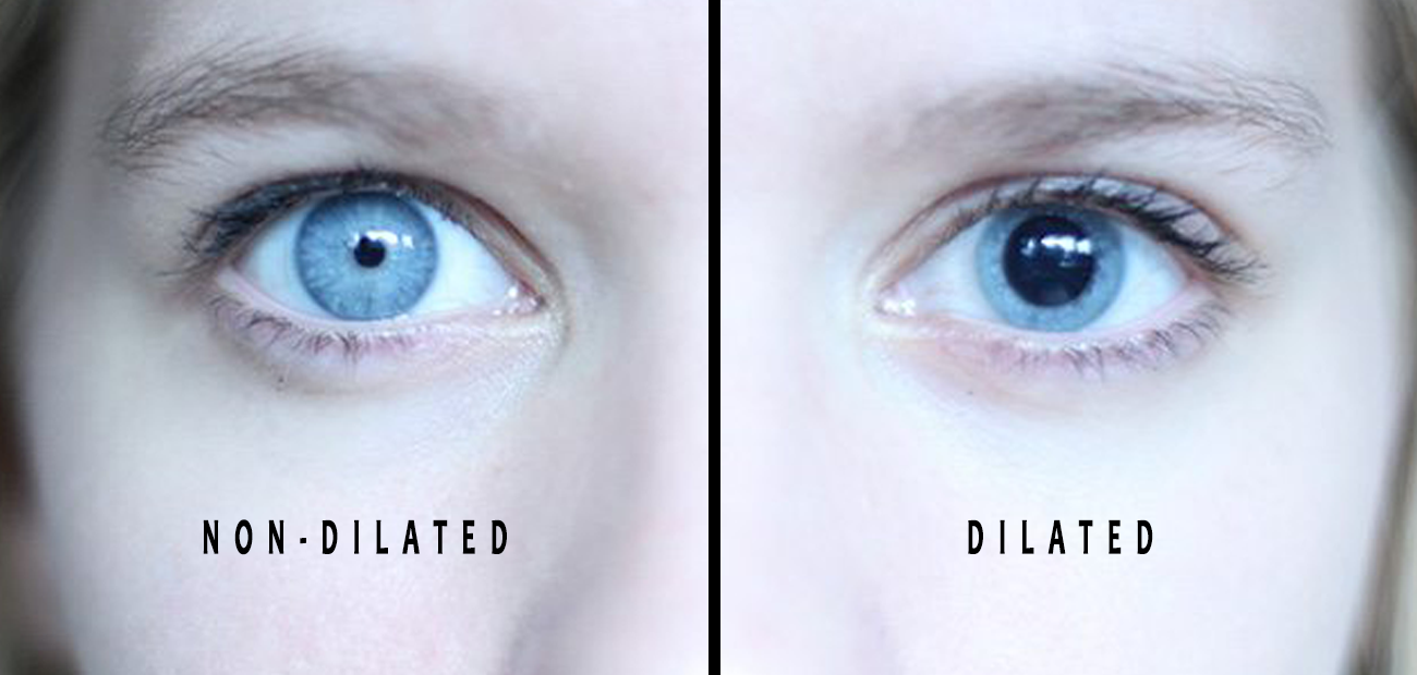 Dilation Retinal Examination Vista Optometry Keratoconus Center
